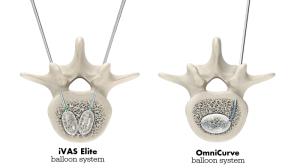 OptaBlate bone tumor ablation system | Interventional Spine